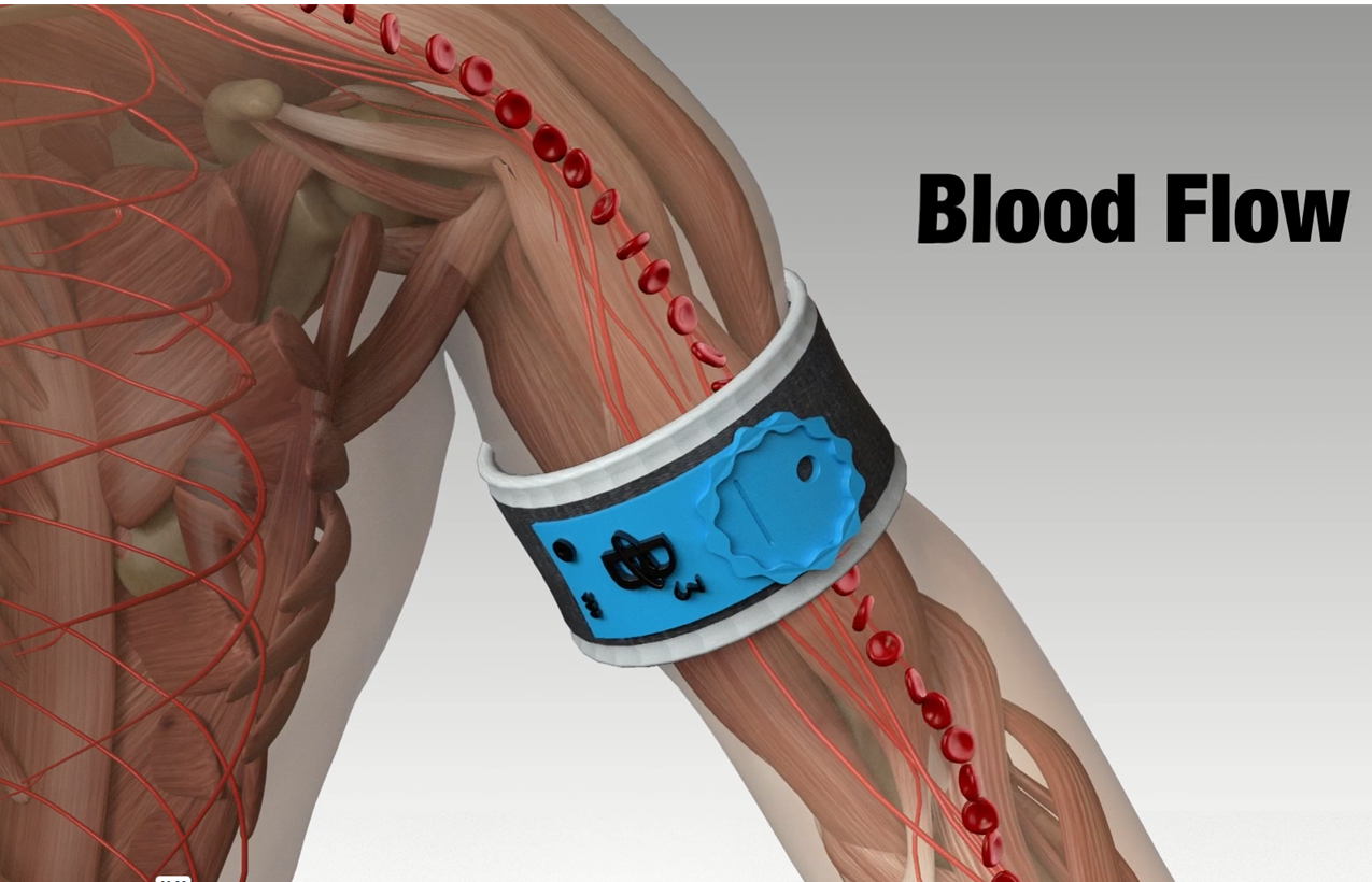 B3 Bands for Blood Clots - B3 Sciences